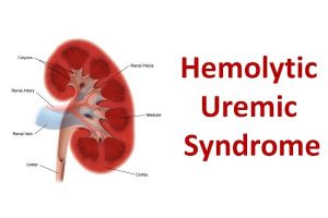 What is HUS Syndrome and its Herbal Treatment?
