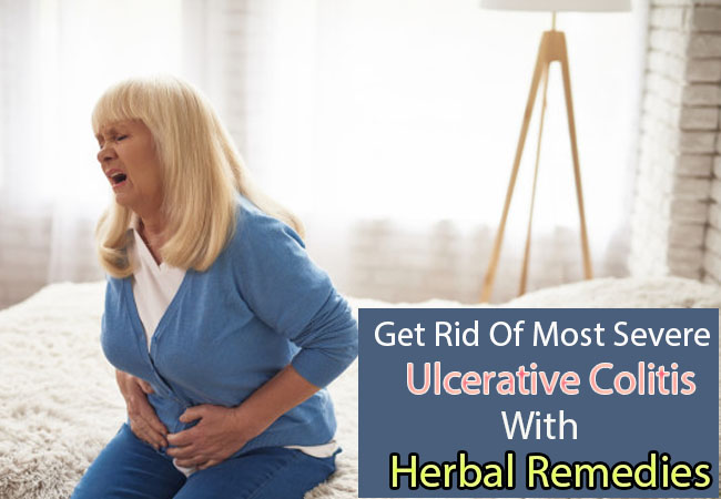 Get Rid Of Most Severe Ulcerative Colitis with Herbal Remedies